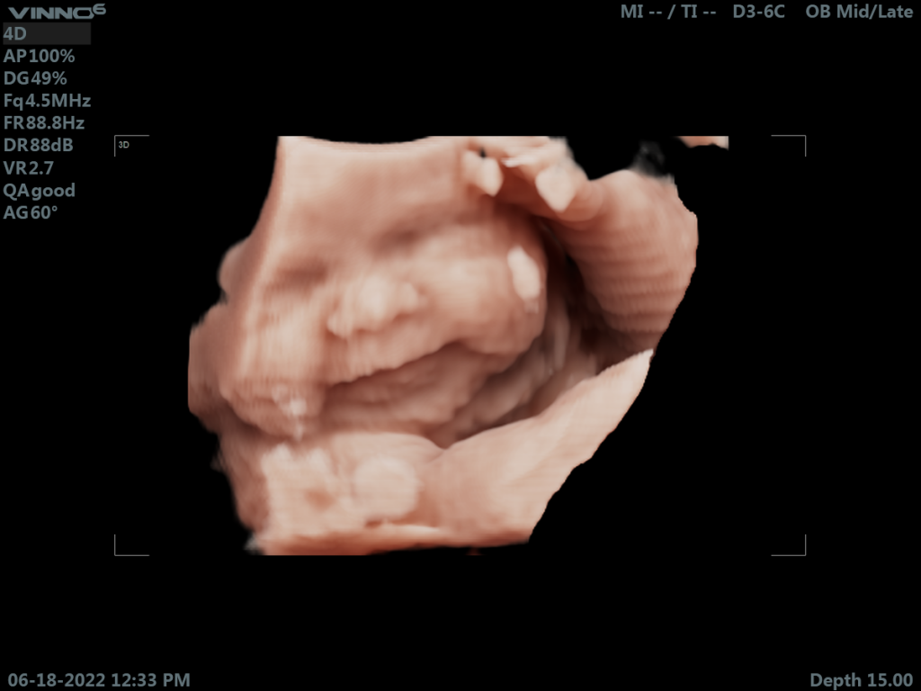 My First Baby Pictures 3D/4D: Mobile Baby Ultrasound